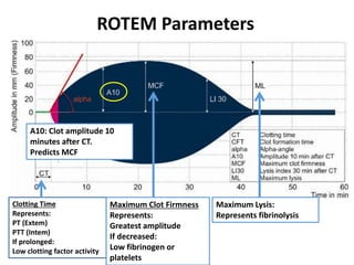 ROTEM - An Introduction and overview.pptx