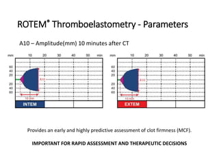 ROTEM - An Introduction and overview.pptx