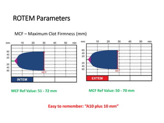 ROTEM - An Introduction and overview.pptx