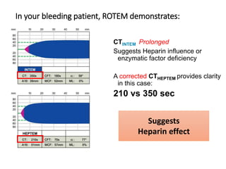 ROTEM - An Introduction and overview.pptx