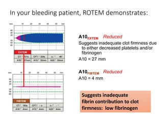 ROTEM - An Introduction and overview.pptx