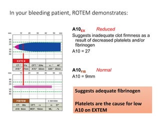ROTEM - An Introduction and overview.pptx