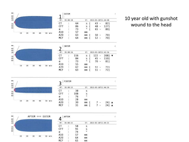 ROTEM - An Introduction and overview.pptx