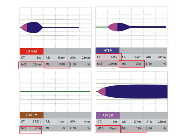 ROTEM - An Introduction and overview.pptx