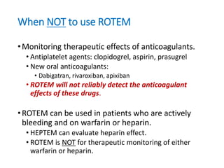 ROTEM - An Introduction and overview.pptx