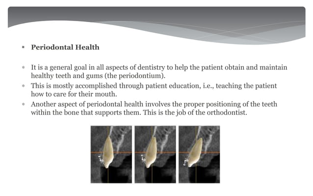 Roth philosophy | PPTX | Dental Health | Diseases and Conditions