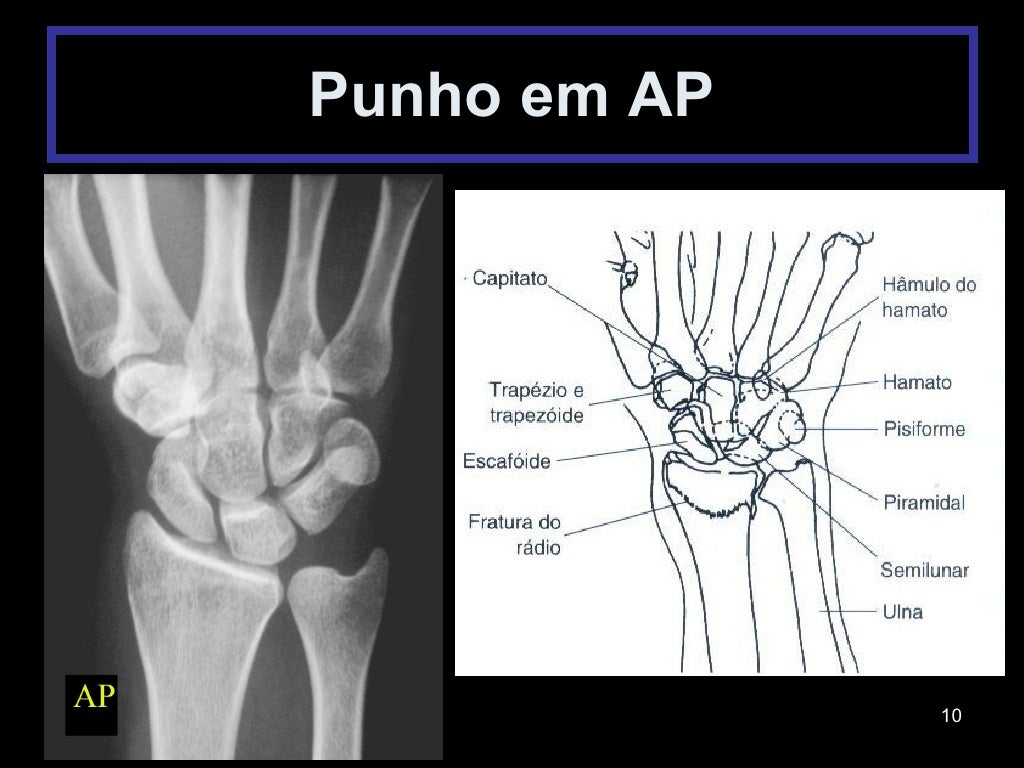 Rotinas Específicas nas Incidências do Punho