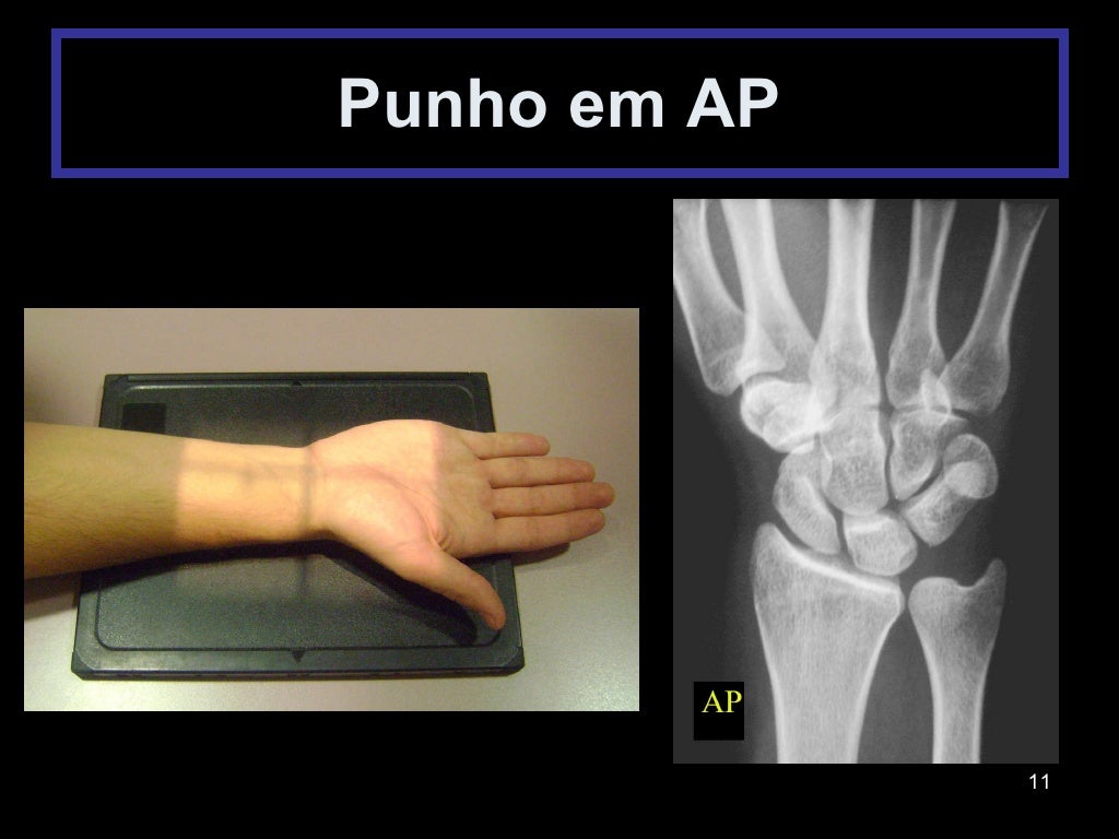 Rotinas Específicas nas Incidências do Punho