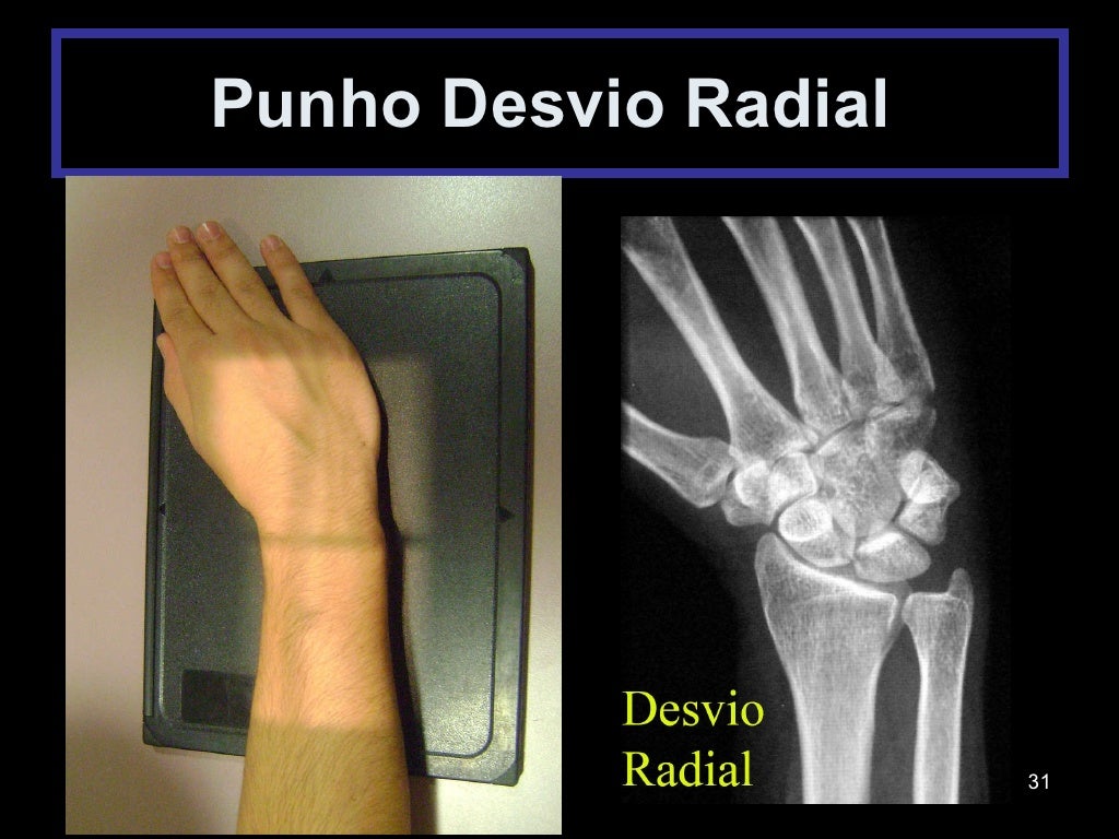 Rotinas Específicas nas Incidências do Punho