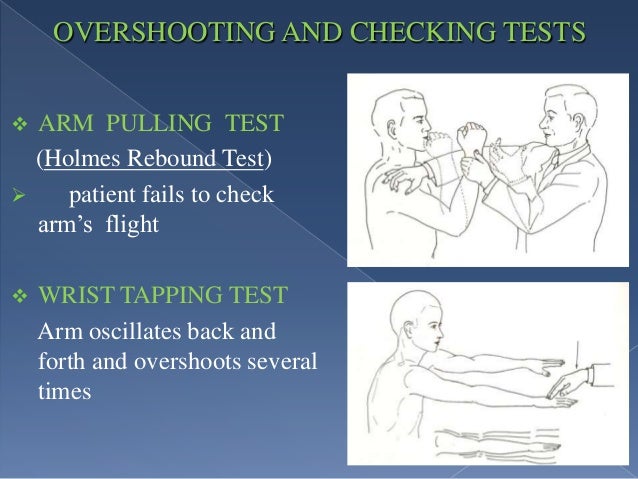 CEREBELLUM & GAIT by Dr ROTO ROBO