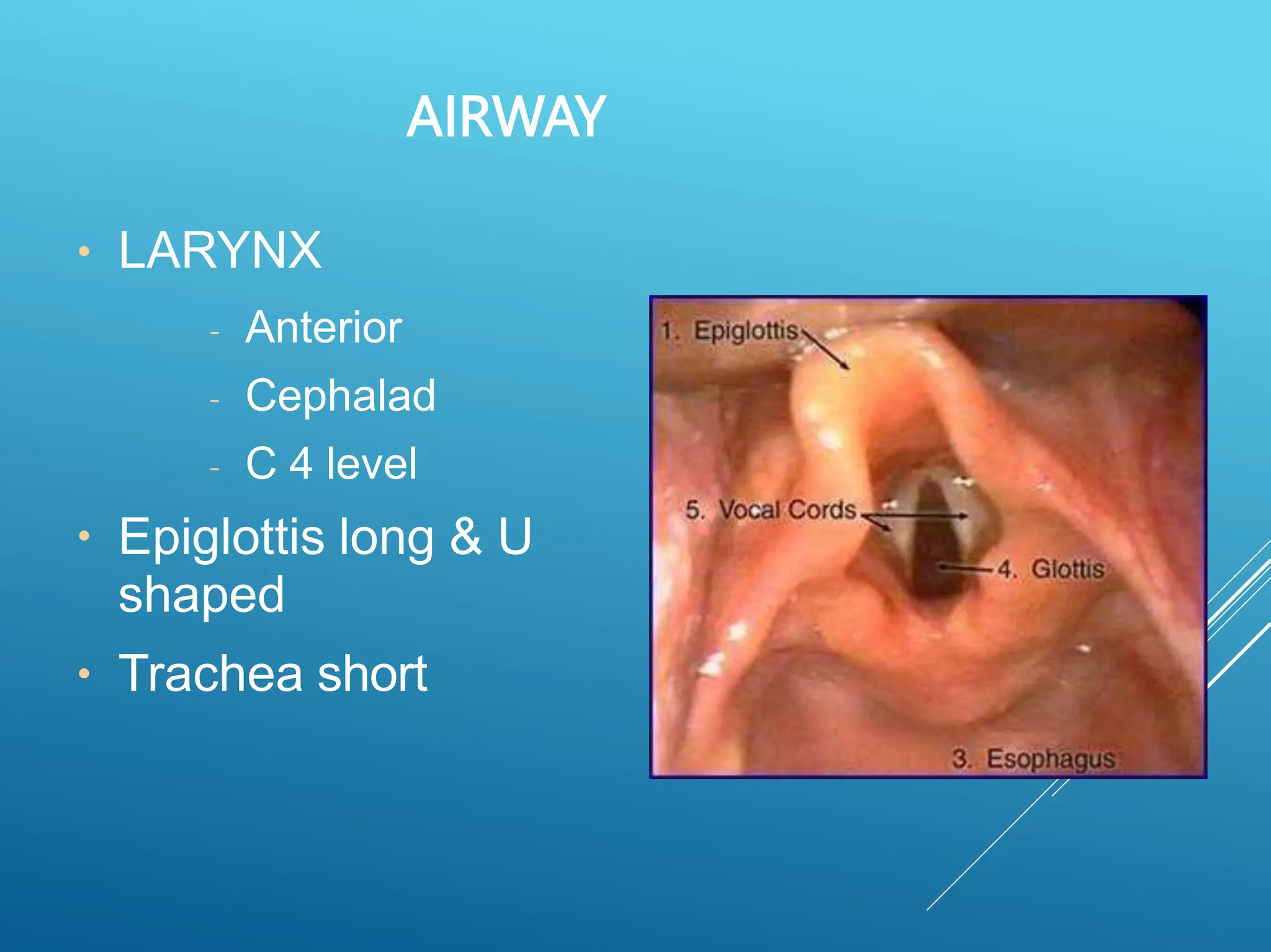 ROUGH DRAFT PPT.pptx for pediatric anaesthesia | PPT