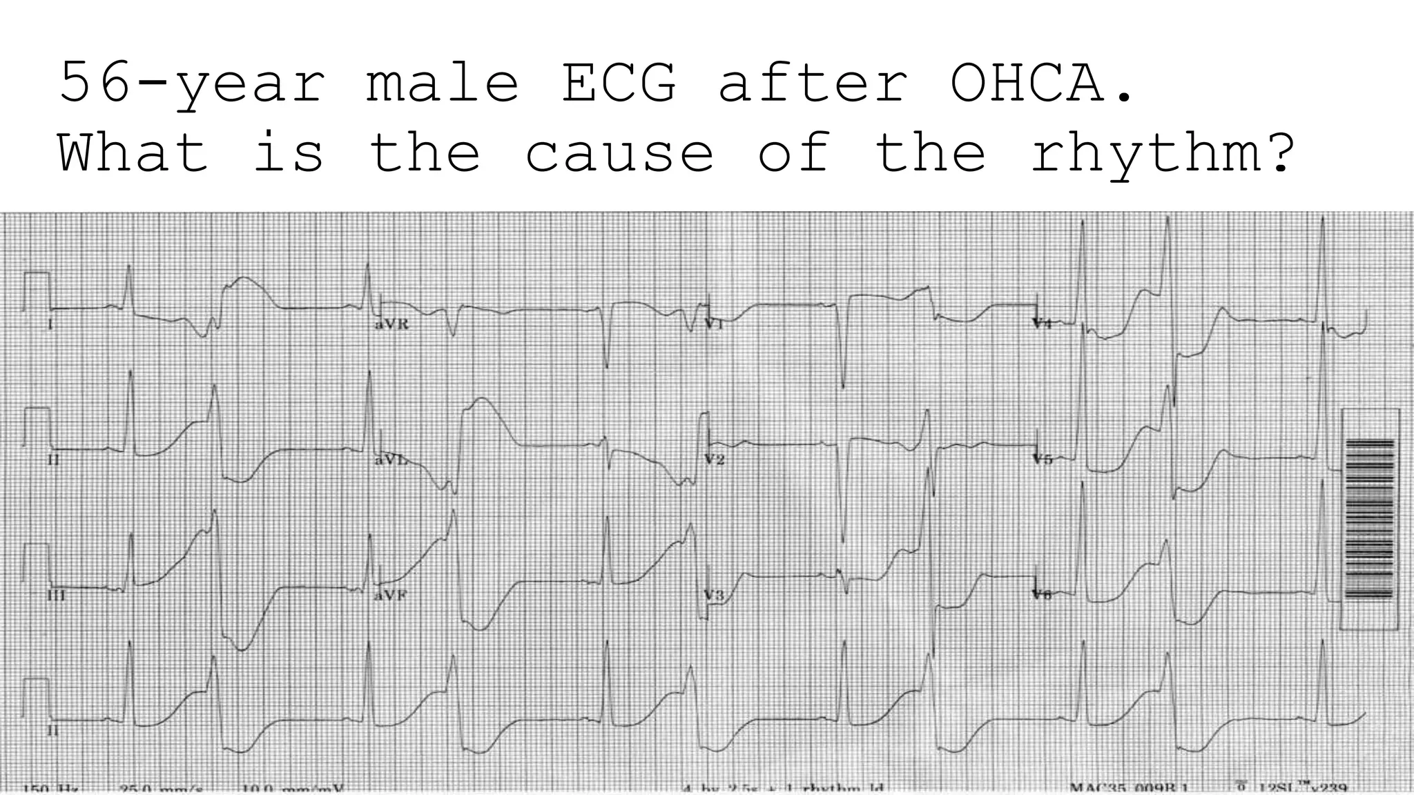 QUIZ INCLUDING THE LEGENDS, ECG, CHEST X RAY, ECHO, CATH AND DEVICES | PPT