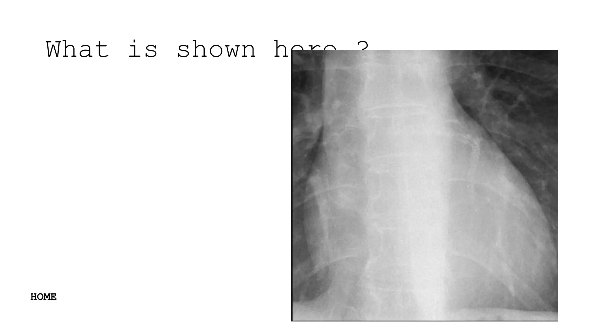 QUIZ INCLUDING THE LEGENDS, ECG, CHEST X RAY, ECHO, CATH AND DEVICES | PPT