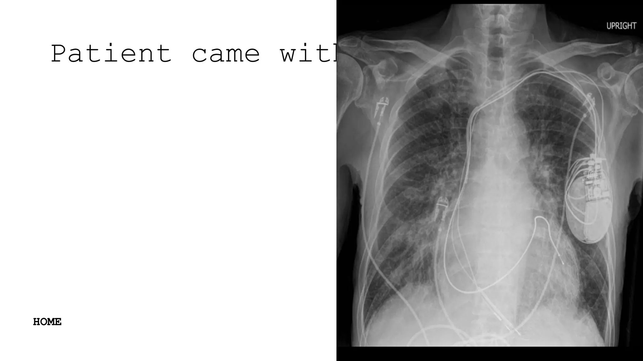 QUIZ INCLUDING THE LEGENDS, ECG, CHEST X RAY, ECHO, CATH AND DEVICES | PPT