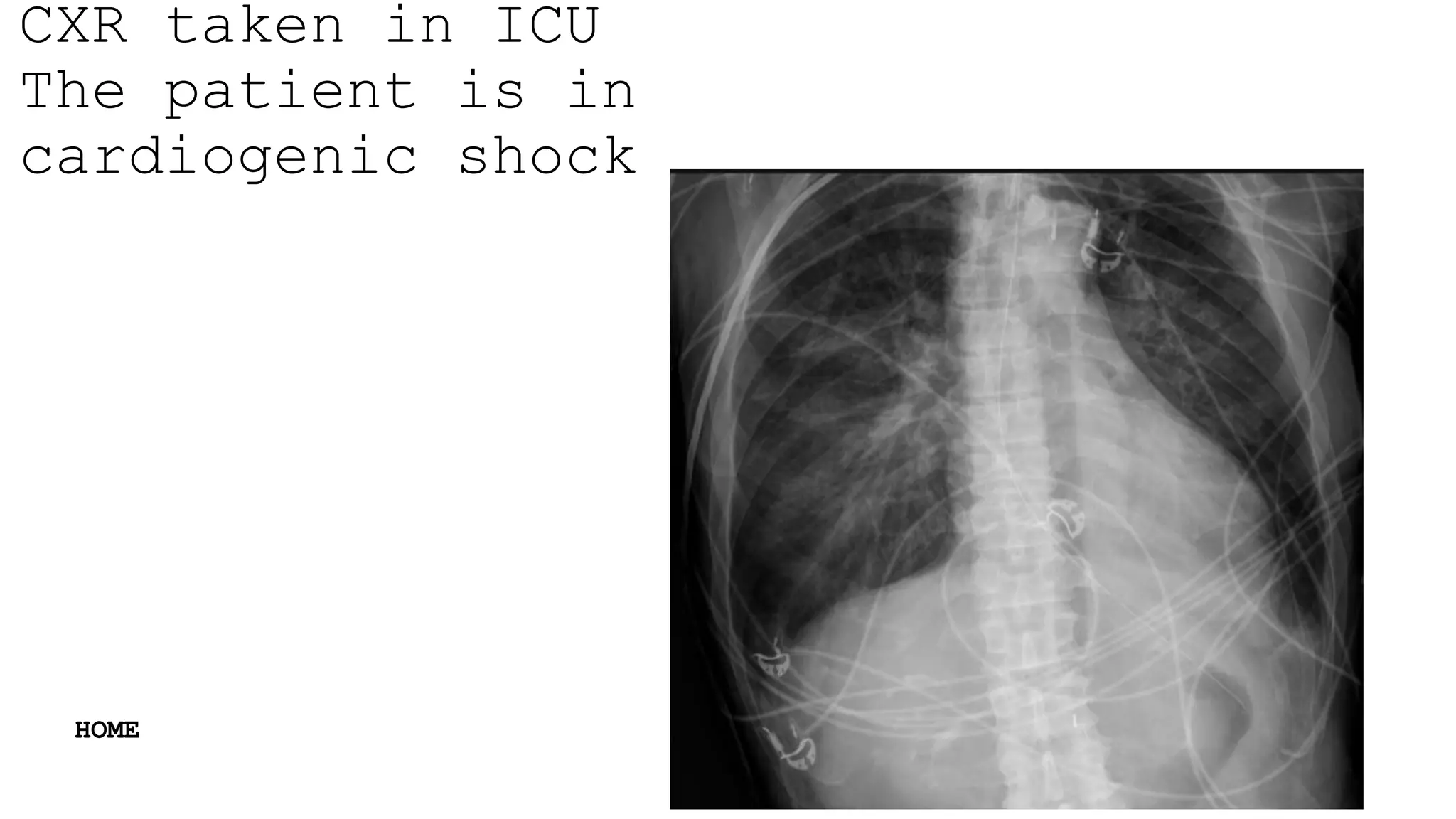QUIZ INCLUDING THE LEGENDS, ECG, CHEST X RAY, ECHO, CATH AND DEVICES | PPT