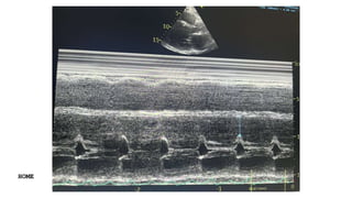QUIZ INCLUDING THE LEGENDS, ECG, CHEST X RAY, ECHO, CATH AND DEVICES | PPTX