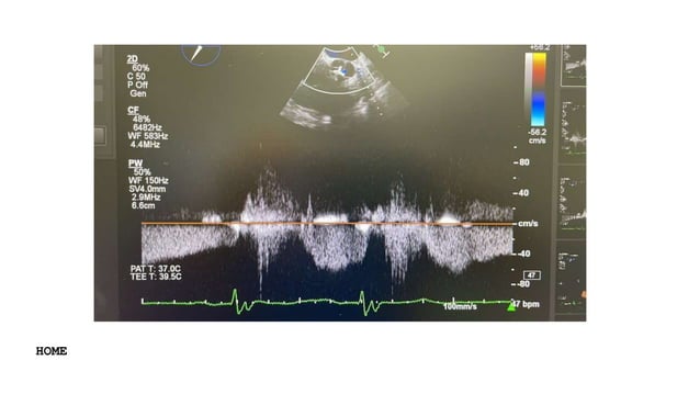 QUIZ INCLUDING THE LEGENDS, ECG, CHEST X RAY, ECHO, CATH AND DEVICES | PPT