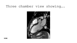 QUIZ INCLUDING THE LEGENDS, ECG, CHEST X RAY, ECHO, CATH AND DEVICES | PPTX