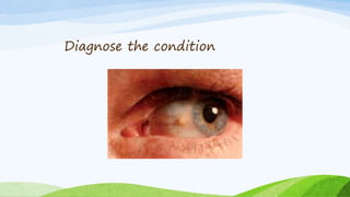 Optometry connection | PPTX