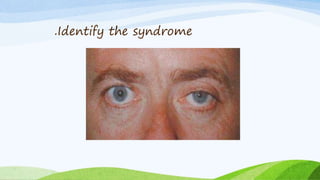 Optometry connection | PPTX