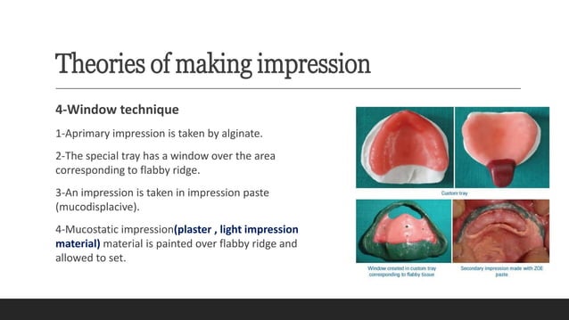 Impression of complete denture | PDF | Oral care | Personal Care