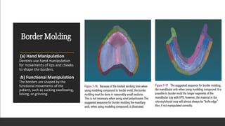 Impression of complete denture | PDF