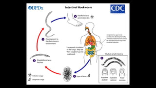 Clinical overview of Roundworm, Hookworm and Pinworm | PPTX