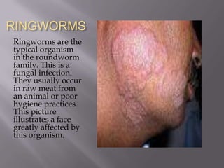 Roundworms (ascaris) | PPTX