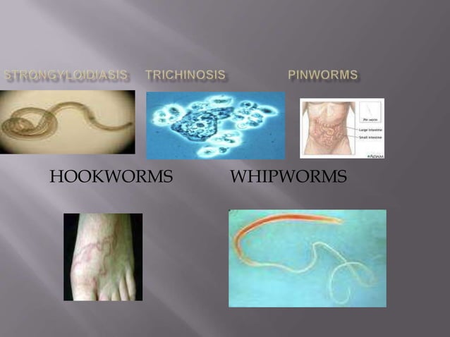 Roundworms (ascaris) | PPTX