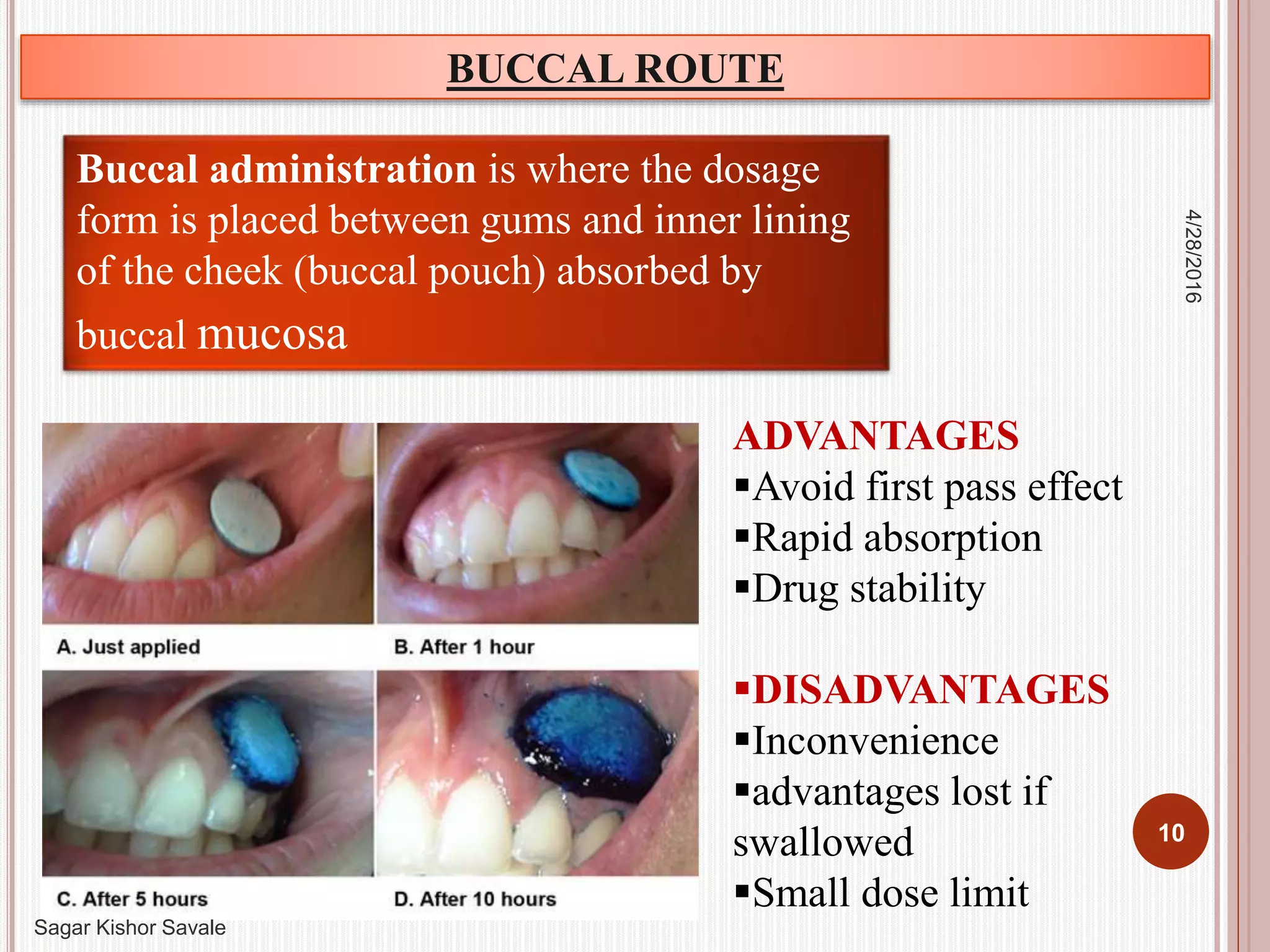 Route of administration and implication on bioavailability | PPTX