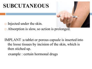Route of Drug Administration | PPTX | Skin and Dermatology | Diseases ...