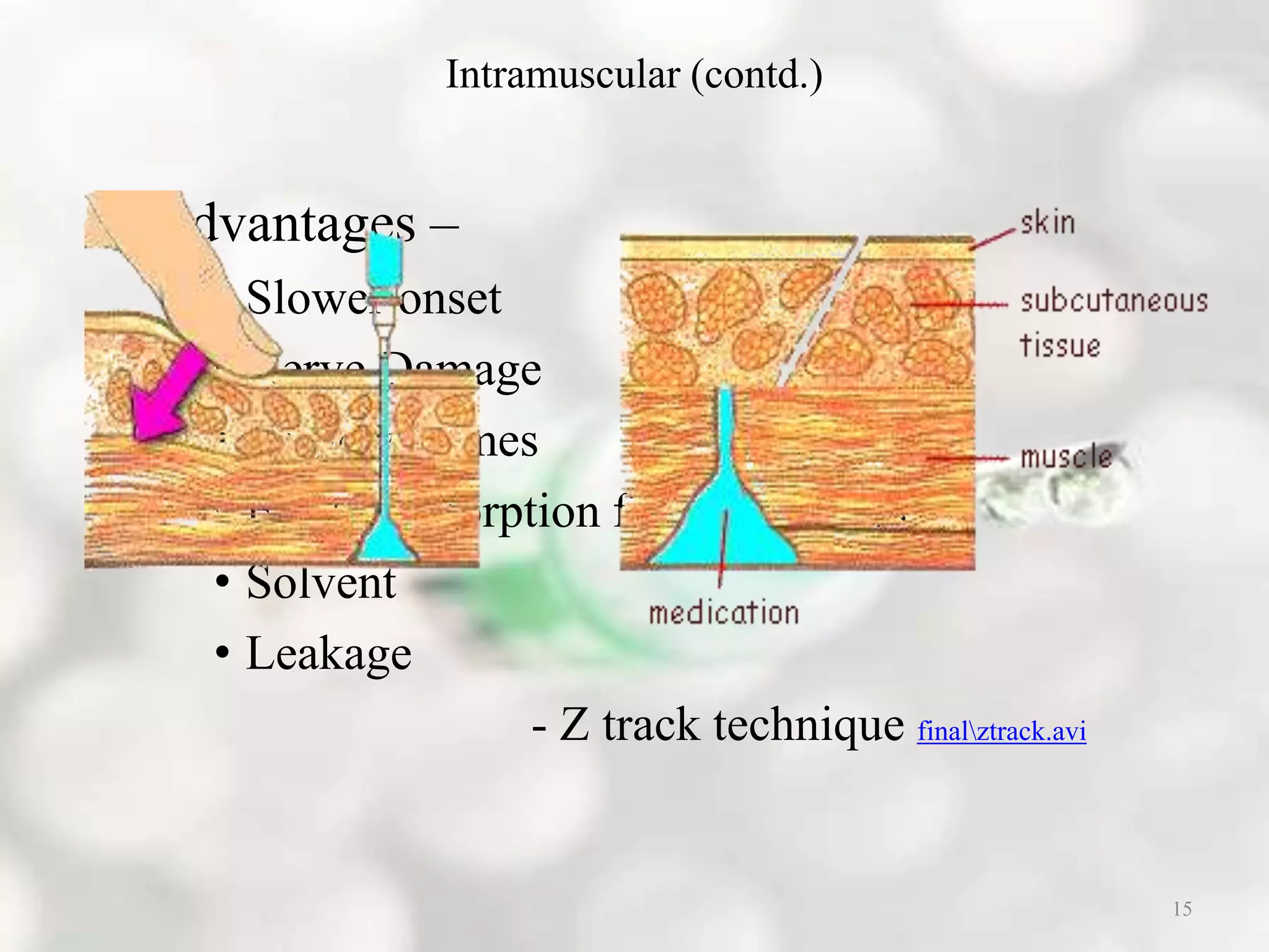 Routes of parenteral administration | PPTX