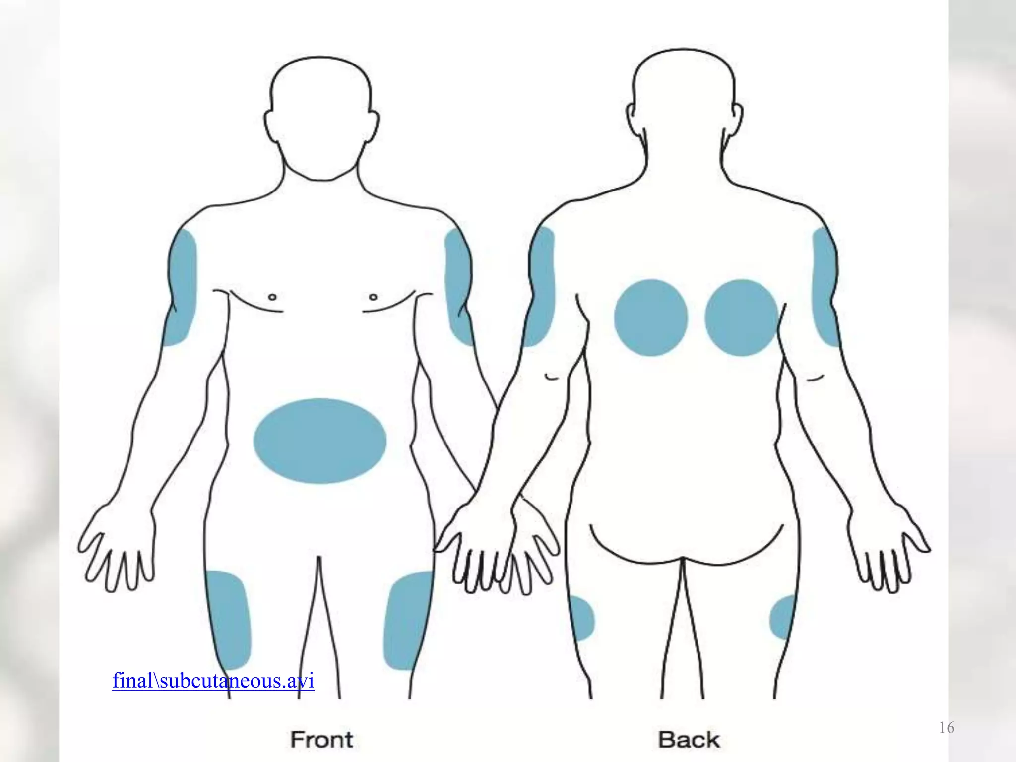 Routes of parenteral administration | PPTX