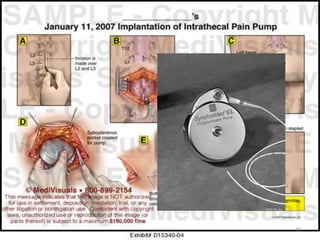Routes of parenteral administration | PPTX