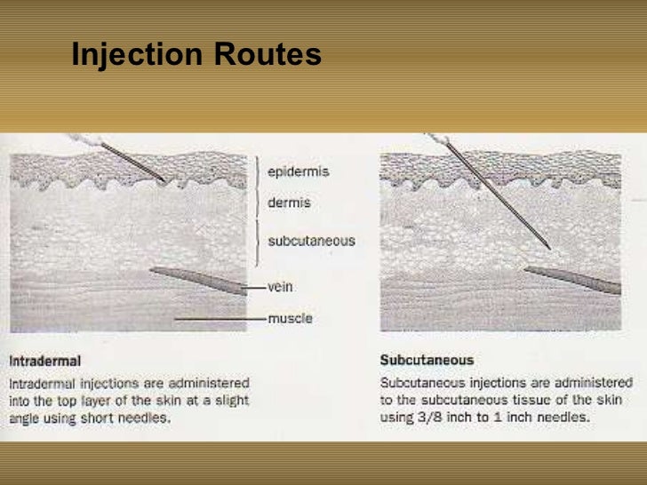 Medication Routes and Dosage Formulations