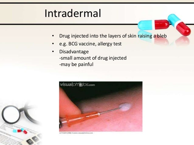 Routes of drug administration