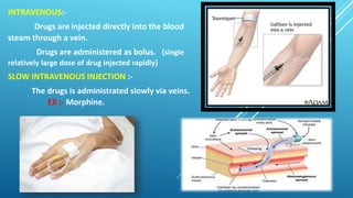 Routes of drug administration | PPTX