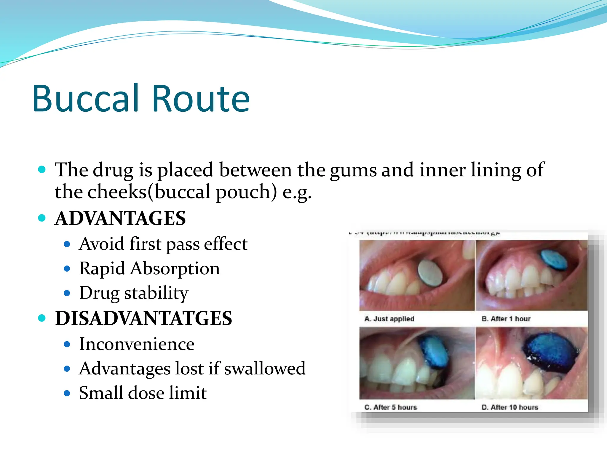 Routes Of Drug Administration by Anushri Srivastava .pptx