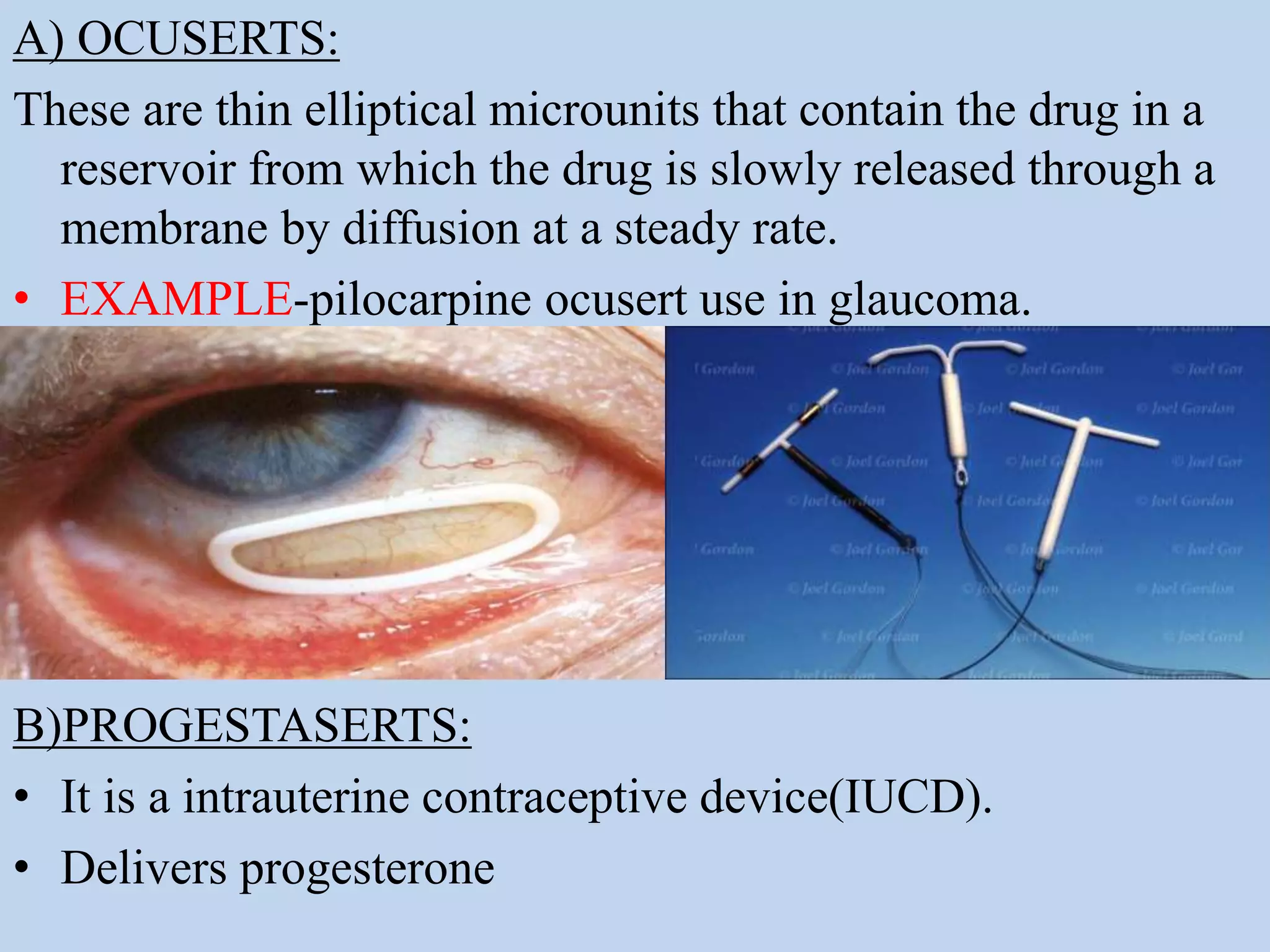Routes of drug administration - Part II for mbbs | PPTX
