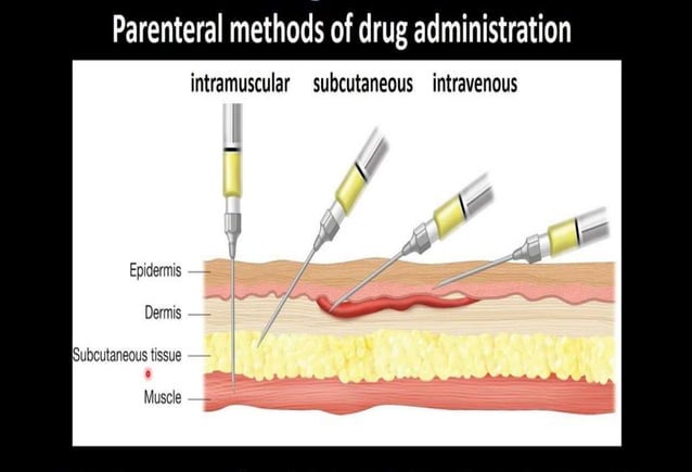 Routes of Drug Administration.ppt | Lung and Respiratory Health ...