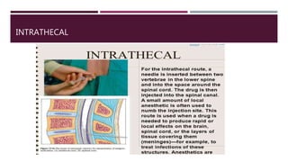 Routes of medication administration advanced techniques | PPTX