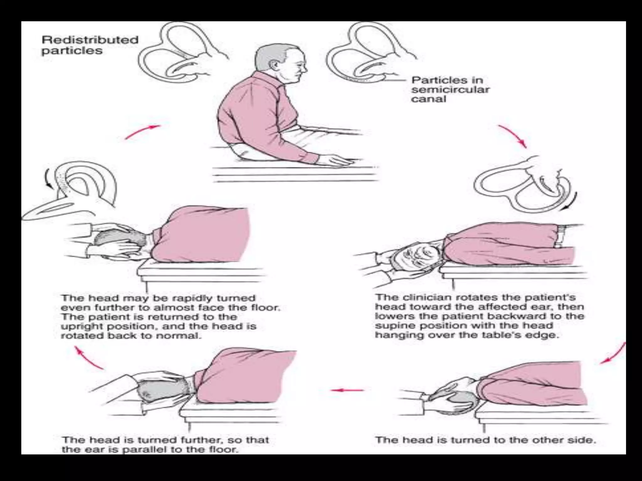 Routine clinical tests of vestibular function | PPT