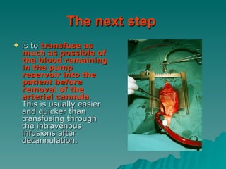 Routine cpb weaning | PPT | First Aid | Injuries