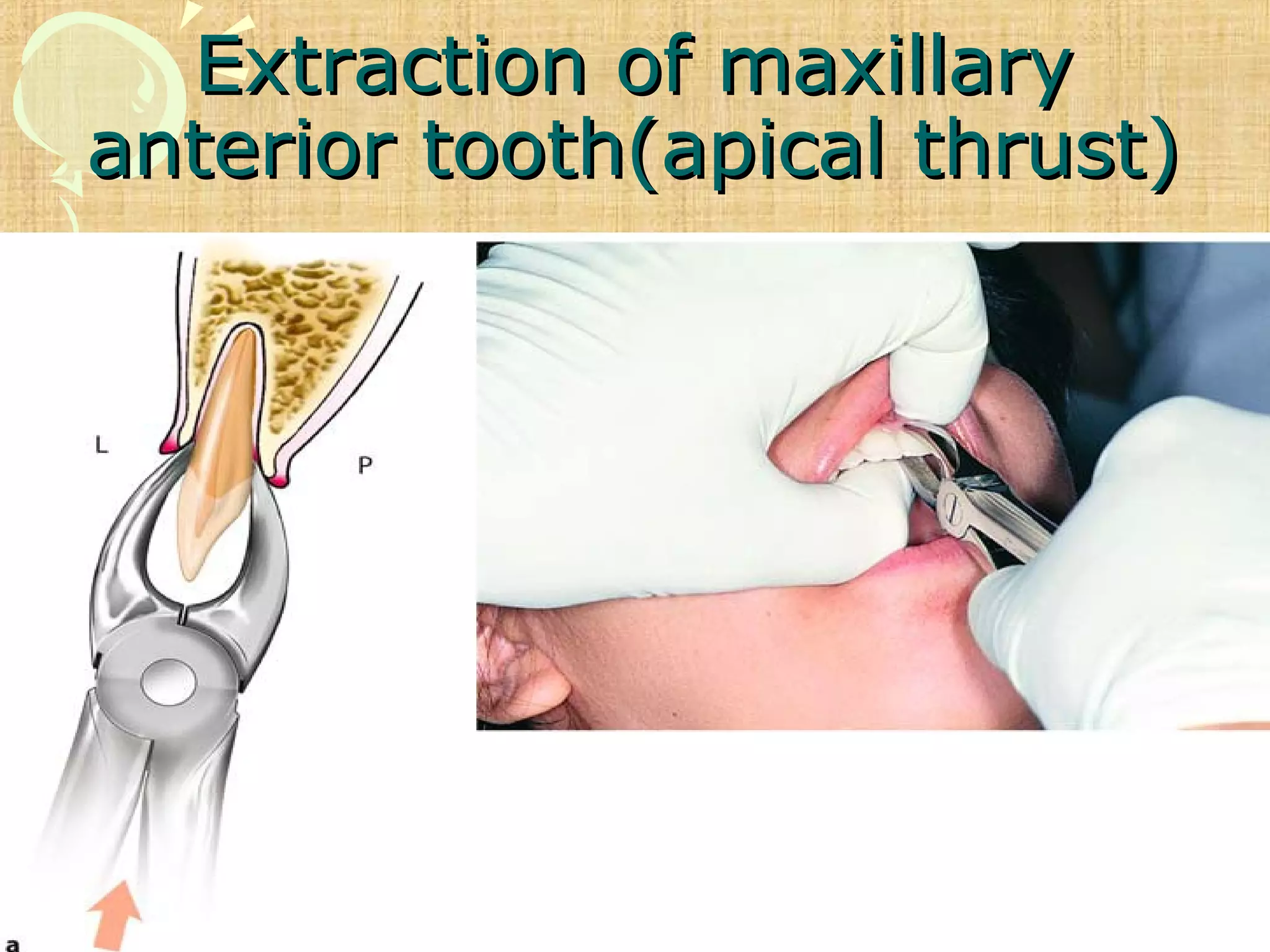 Routine extraction | PPT
