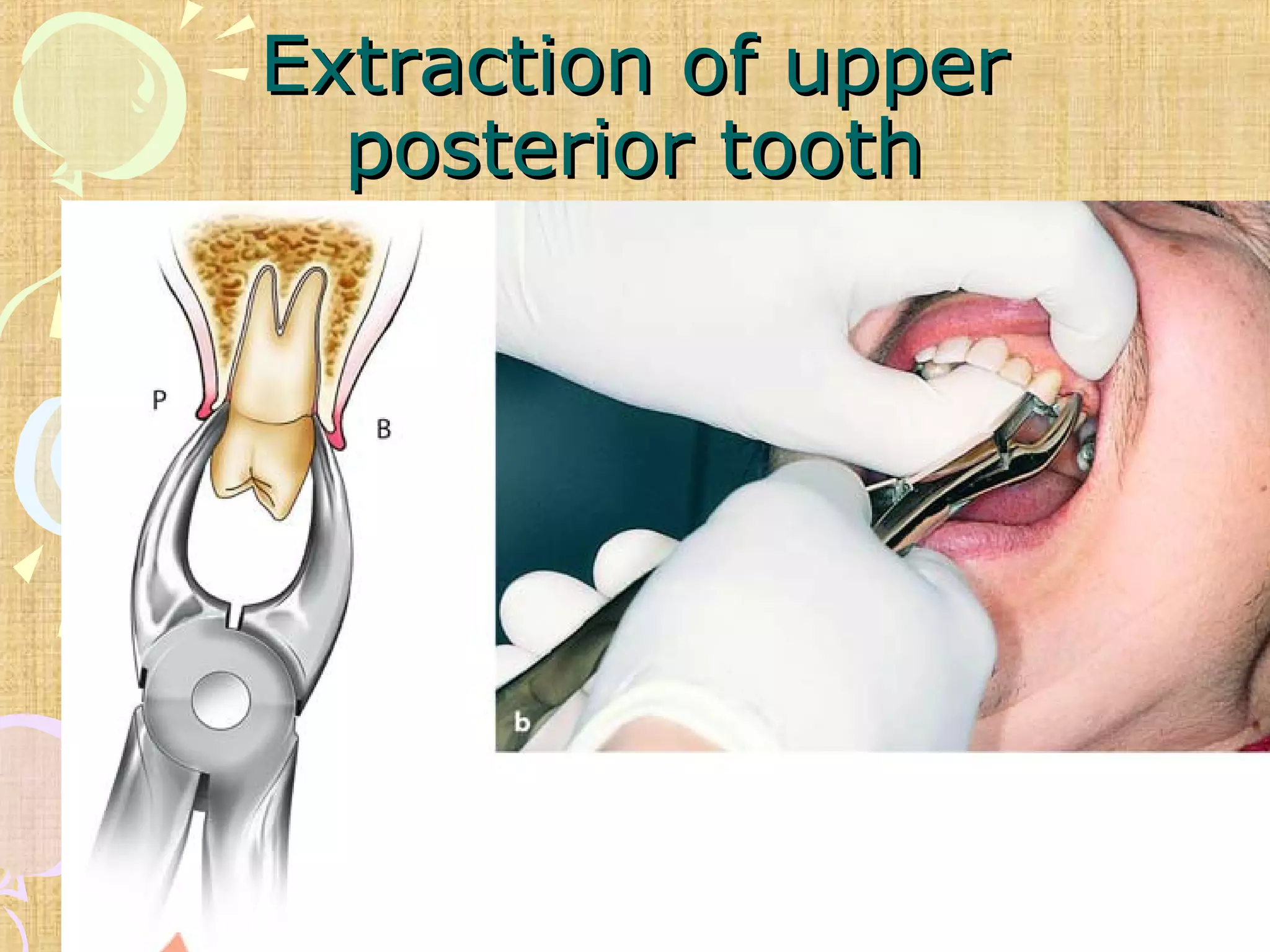 Routine extraction | PPT