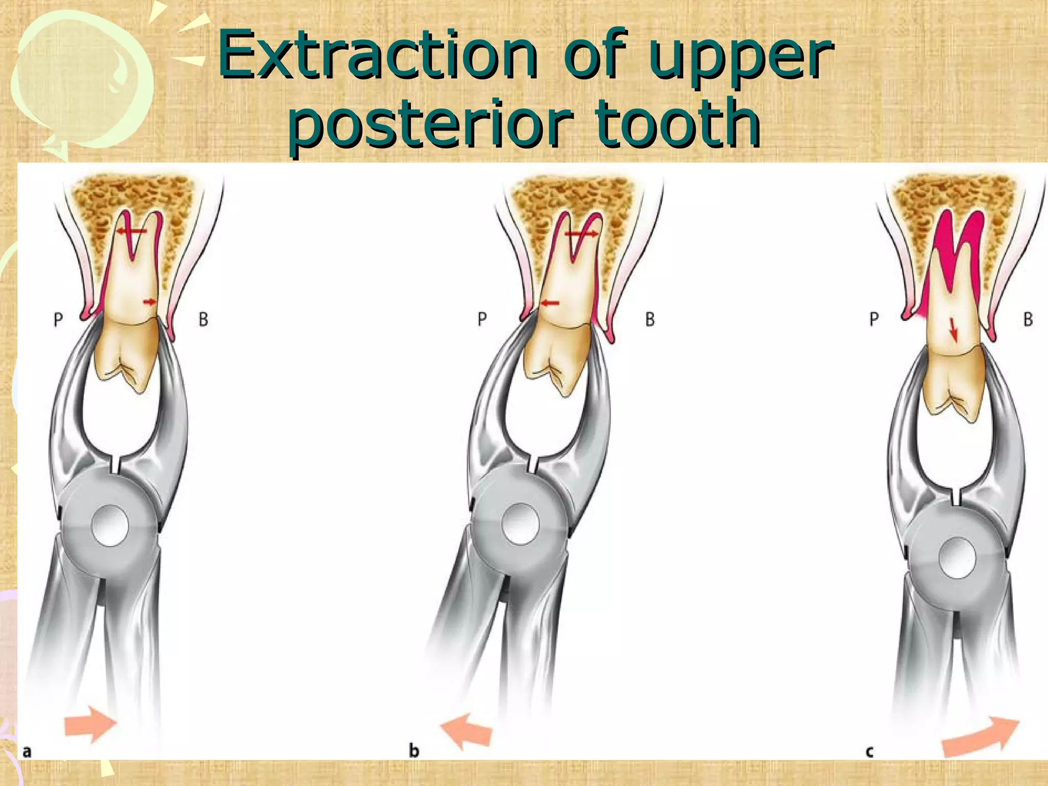Routine extraction | PPT