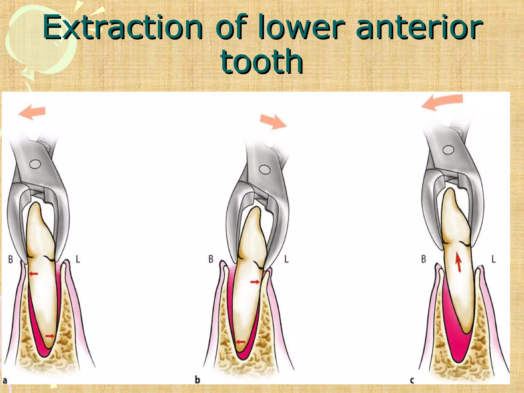 Routine extraction | PPT