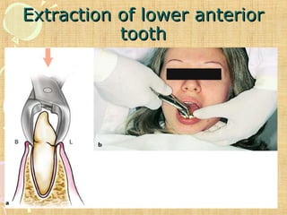 Routine extraction | PPT