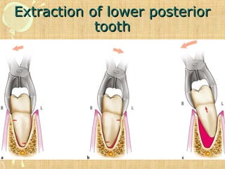 Routine extraction | PPT