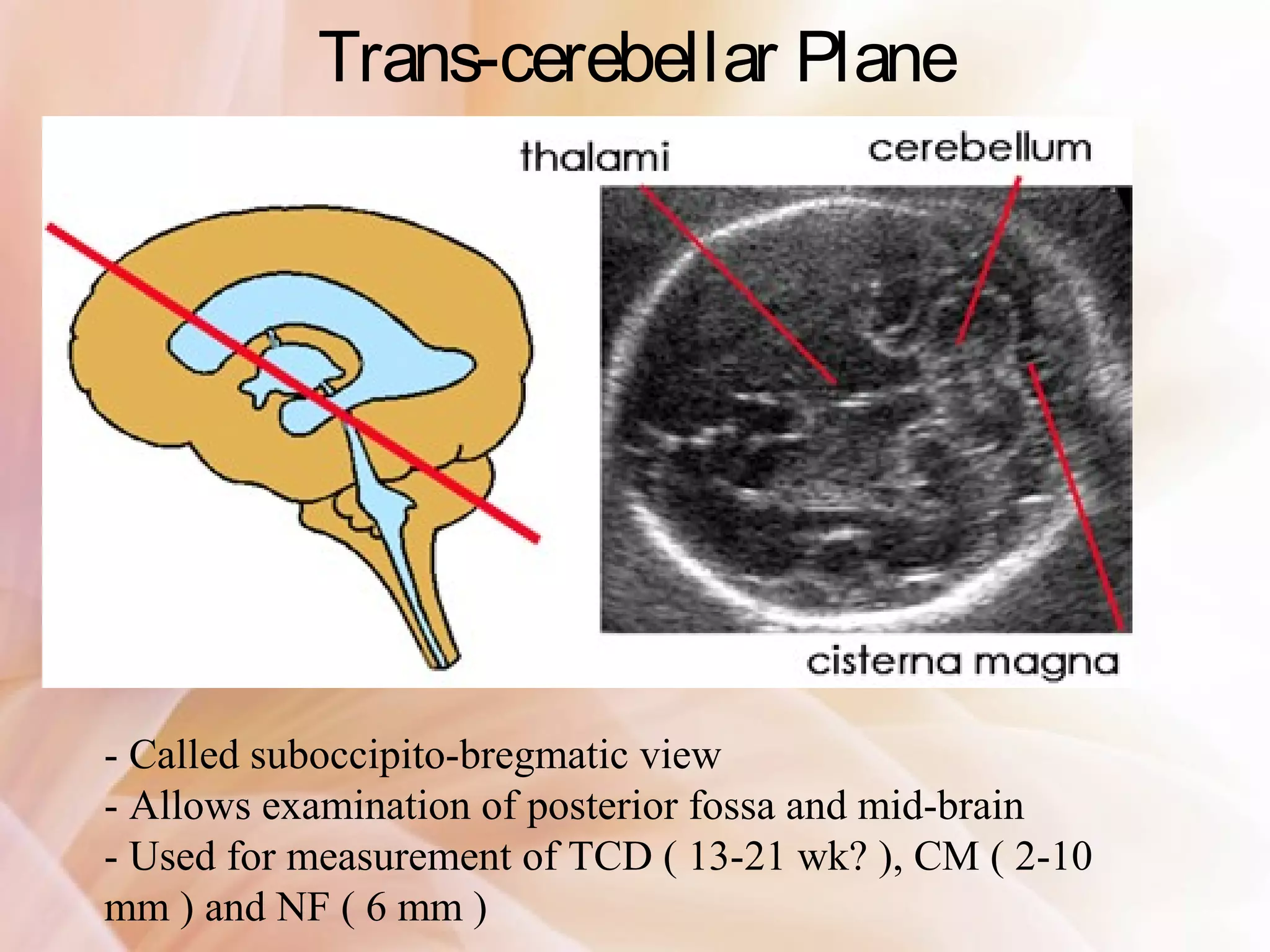 Routine fetal anatomy scan at 18-23 weeks | PPT
